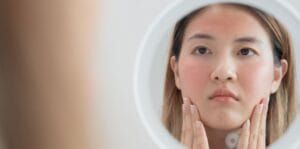 Can Liver Damage Cause Rash? | Nation Health MD
